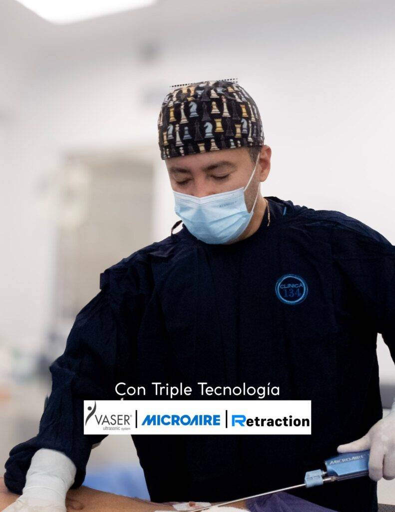 ¿Qué es la Lipectomía y cómo funciona? - Dr. Leonardo Rueda